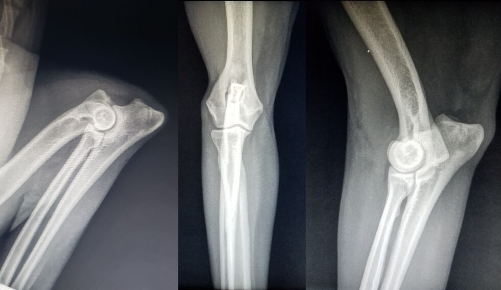 Dépistage officiel des dysplasie des Hanches et des Coudes | CFBA